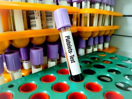 10 Ciri Demam Berdarah Dengue atau DBD untuk Deteksi Dini - Qoala Indonesia